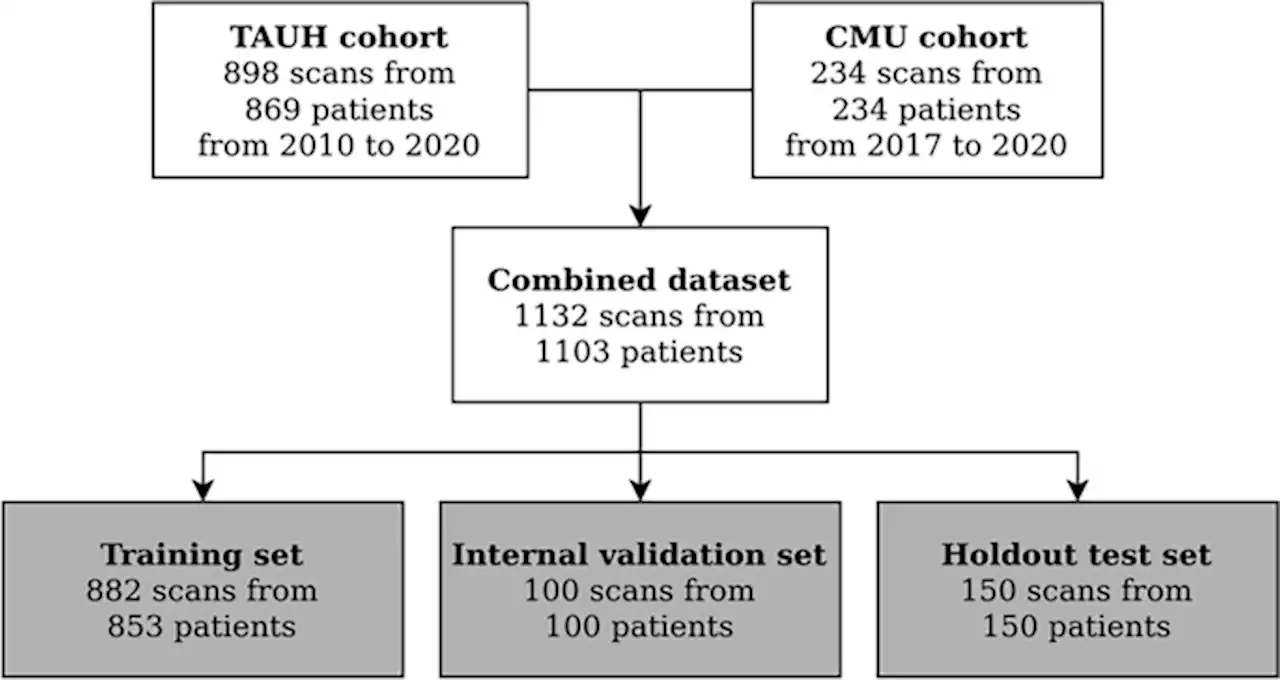 Comparison Of Deep Learning Segmentation And Multigrader Annotated Mandibular Canals Of